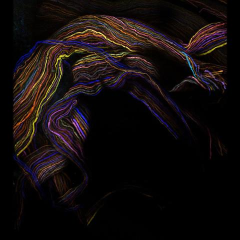 Image Gallery: Neuron Structure | The Franklin Institute